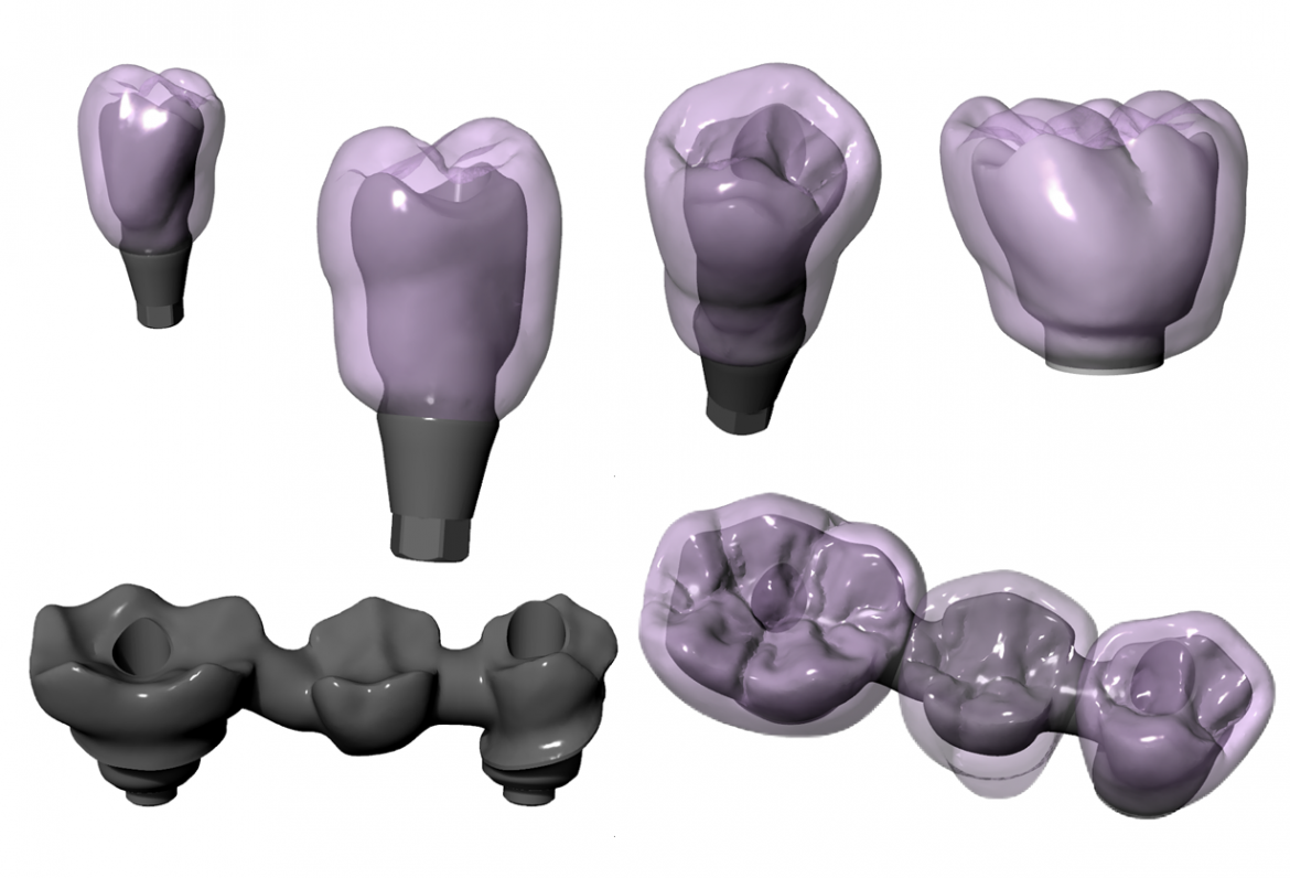 Implant Libraries - Target3D