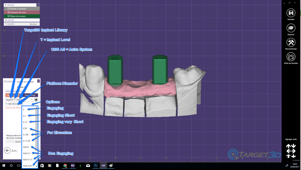 Implant Libraries - Target3D